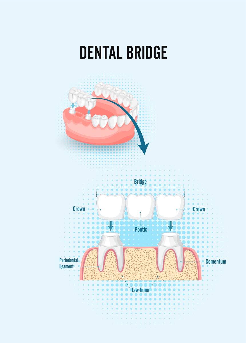 MiraMar Family Dental | Restorative Dentistry